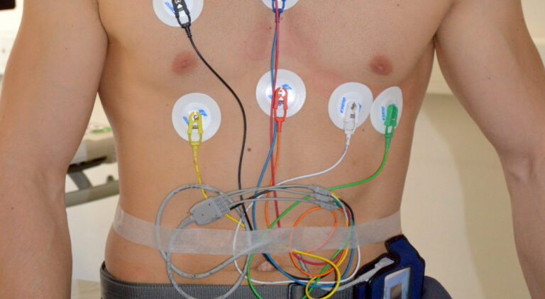 24 urni EKG (Holter monitoring) – Ambulanta Gulič